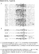 SYNERGY-BETWEEN-EPILEPTOGENIC-CORTEX-AND-THALAMUS-PROJECTING ...