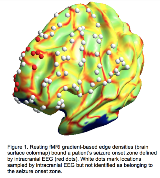 Gradient-based-resting-fMRI-parcellation-for-mapping-functional-and ...