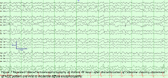 Cefepime-Induced-Neurotoxicity-Presenting-with-Non-Convulsive-Status ...