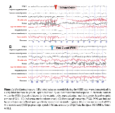 Anatomical-Electro-Clinical-Correlations-During-SEEG-Recorded-Fixation ...