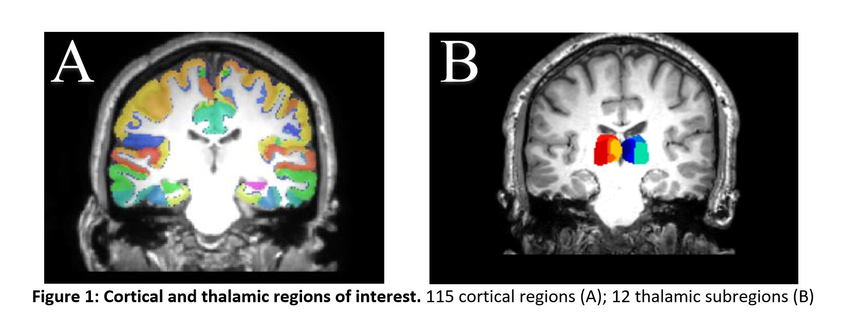 mri functional connectivity between thalamic and cortical brain regions
