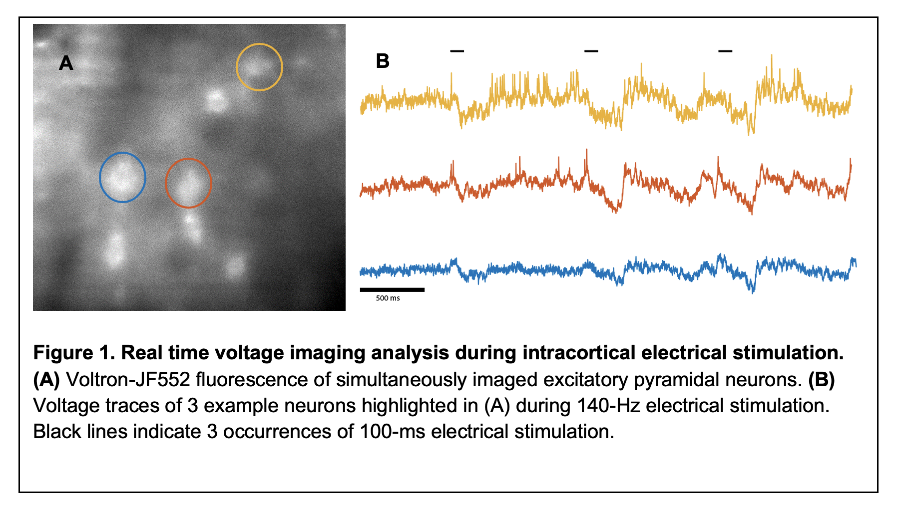 voltage imaging analysis of intracranial electrical stimulation effect ...